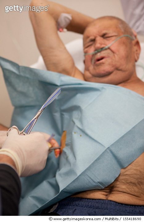 155418690 | 게티이미지코리아 | praparin to insert a chest tube Royalty-Free 이미지